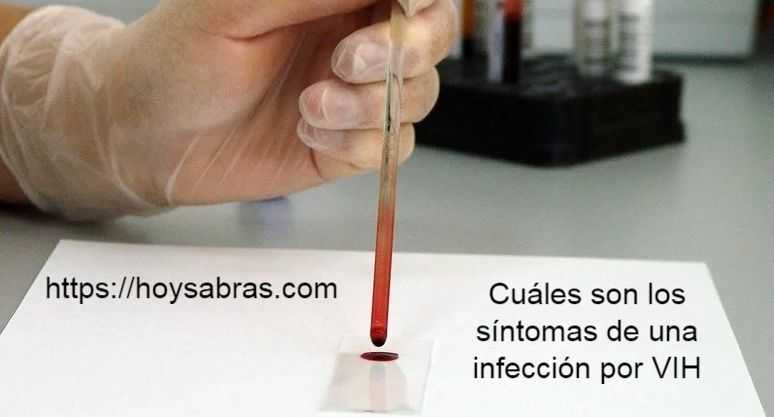¿Cuáles Son Los Síntomas De Una Infección Por VIH? 2025